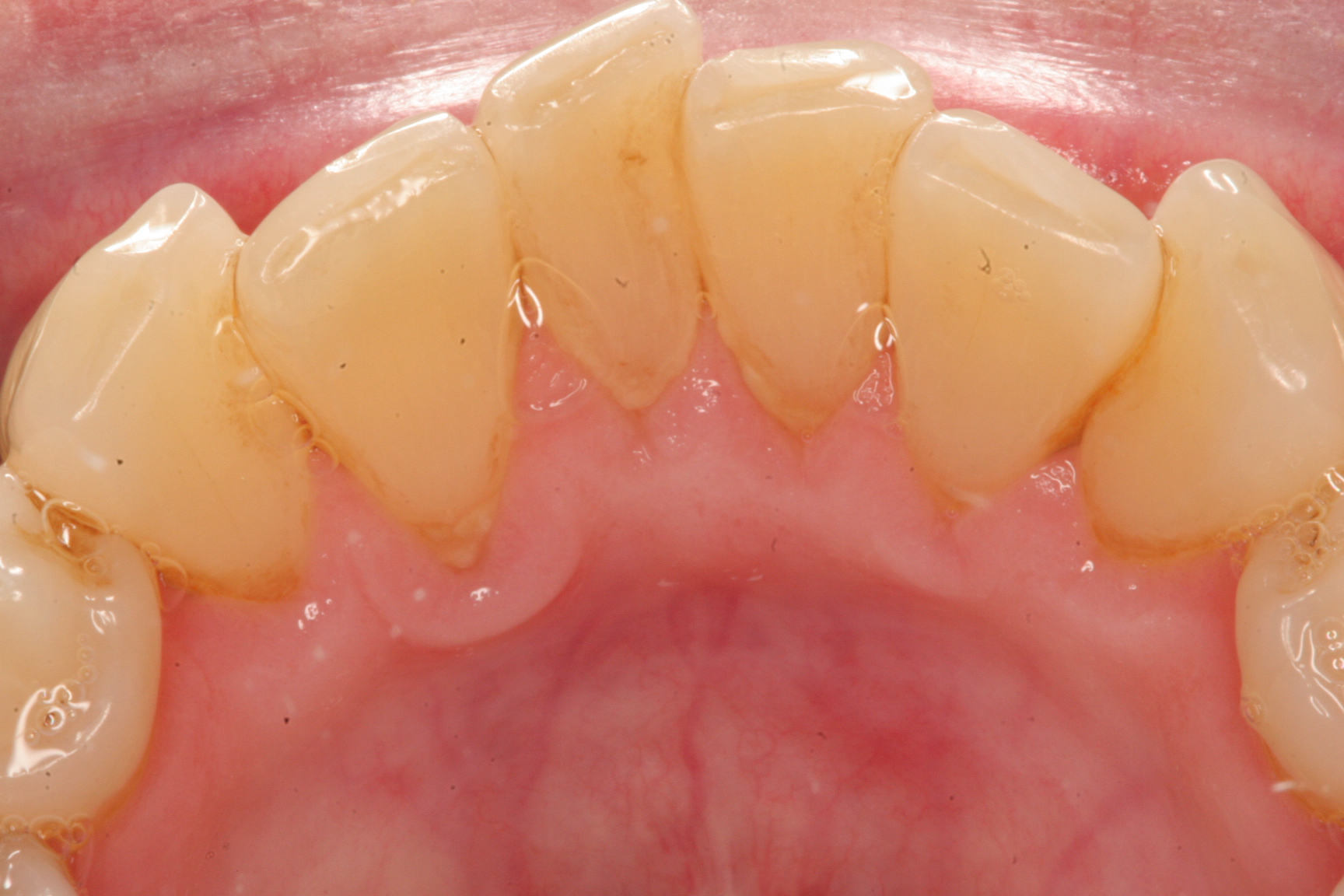 Tandartspraktijk Zuilen en Parkwijk | Behandelingen - Tandartspraktijk ...